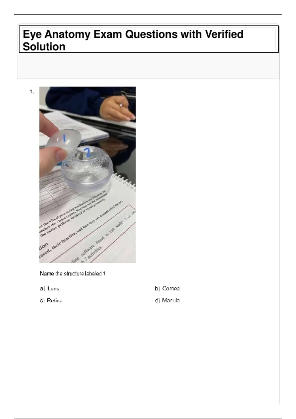 Eye Anatomy Exam Questions with Verified Solution - Anatomy - Stuvia US