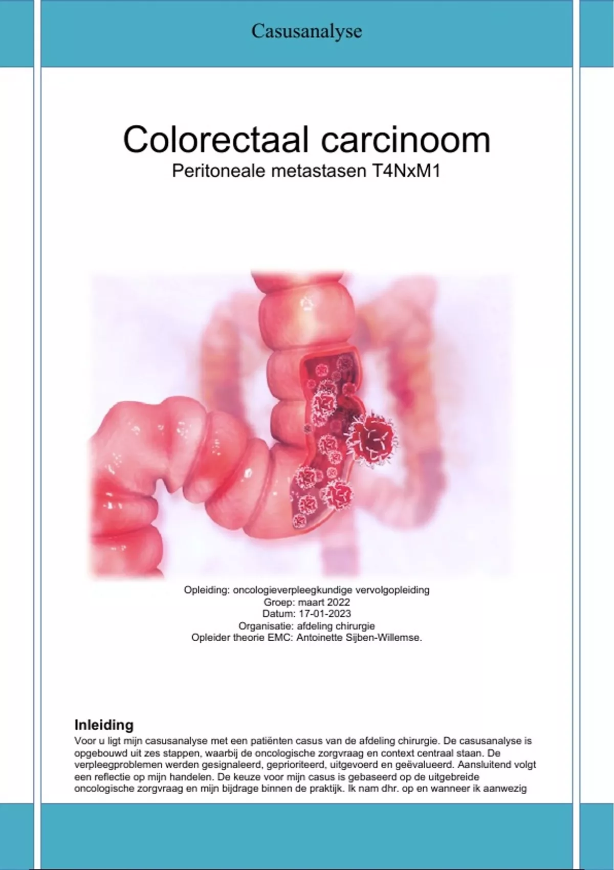 Casusanalyse colorectaal carcinoom oncologie vervolgopleiding EMC uit ...