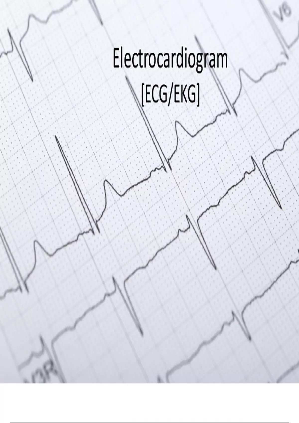 Learning to read 12 lead EKGs and abnormal rhythms - Stuvia US
