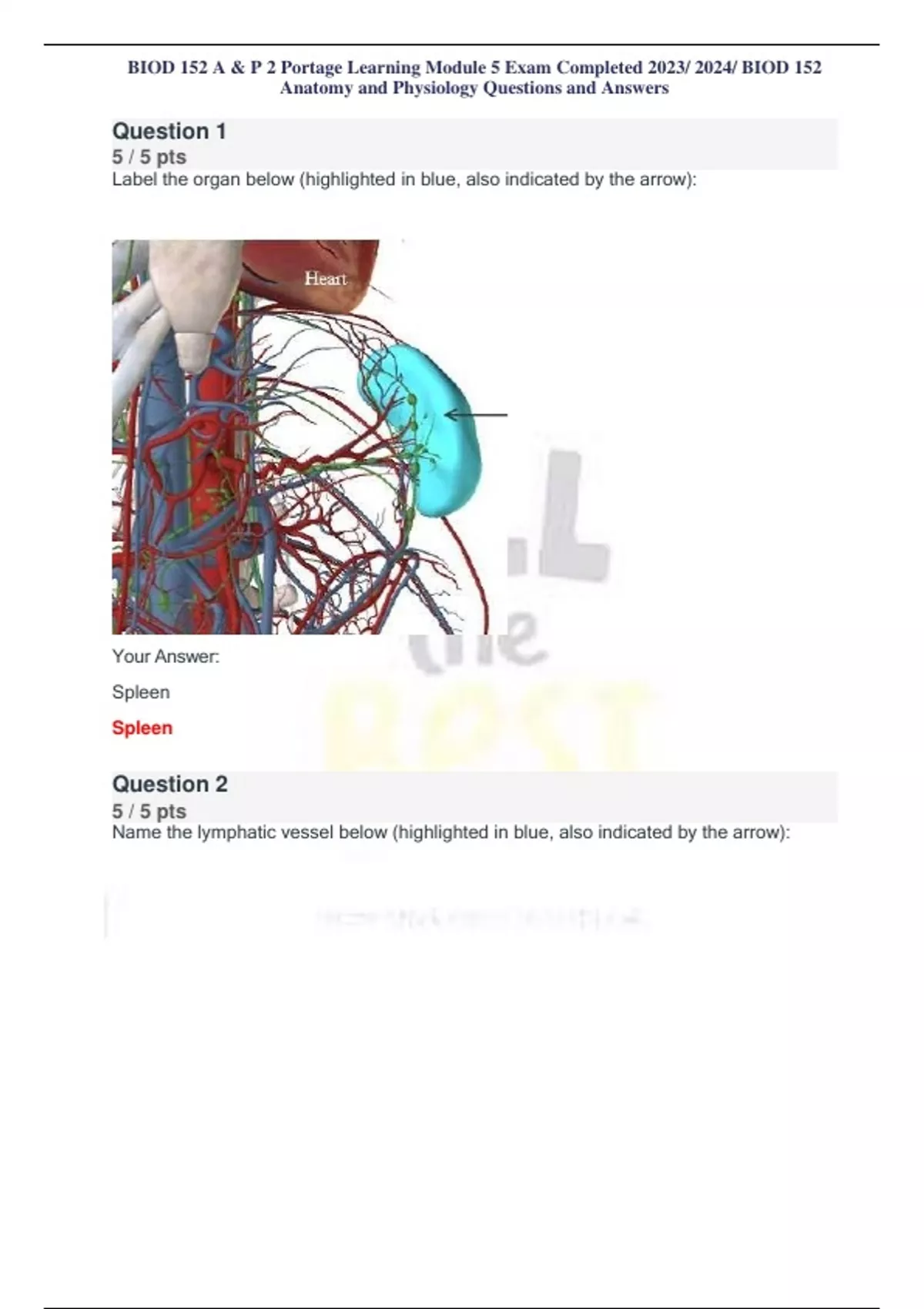 BIOD 152 A & P 2 Portage Learning Module 5 Exam Completed 2023/ 2024 ...