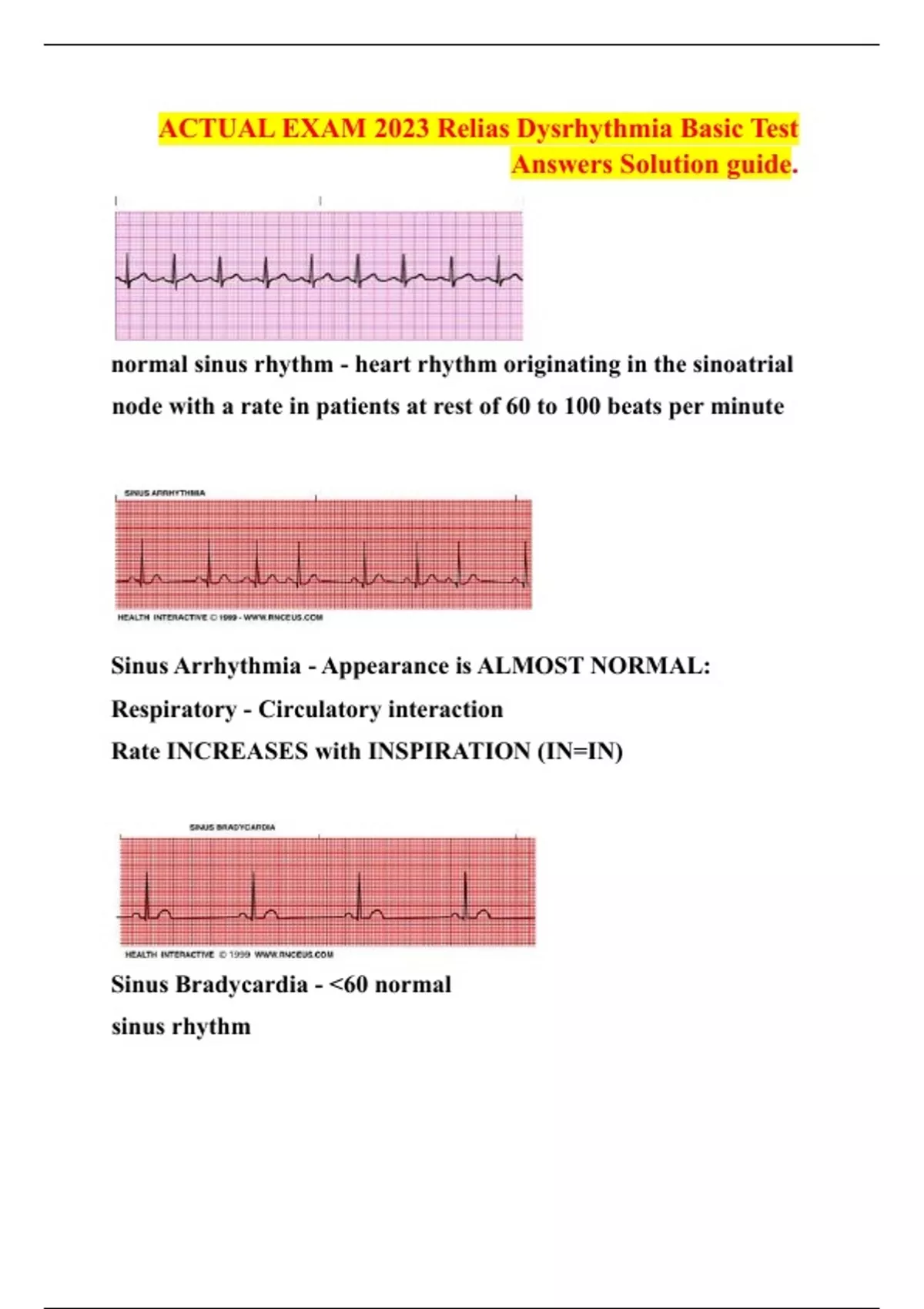 ACTUAL EXAM 2023 Relias Dysrhythmia Basic Test Answers Solution guide ...