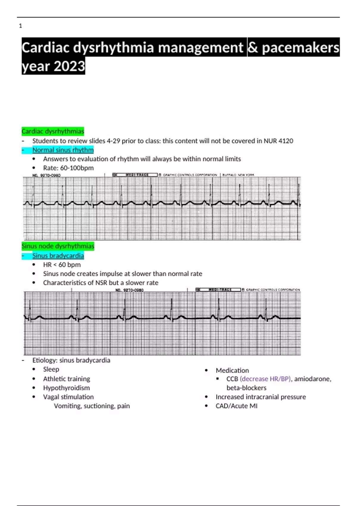 Cardiac dysrhythmia management & pacemakers year 2023 - Cardiac dysrhythmia - Stuvia US