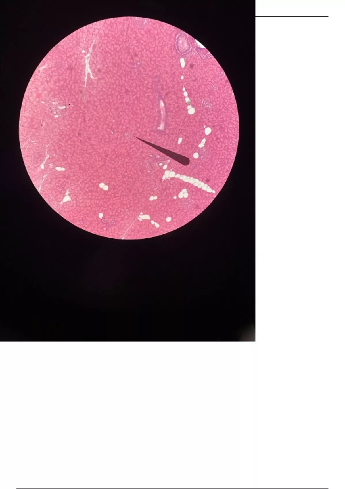 Histology of the Pancreas - Labeling Diagram - ANAT231 (ANAT231 ...