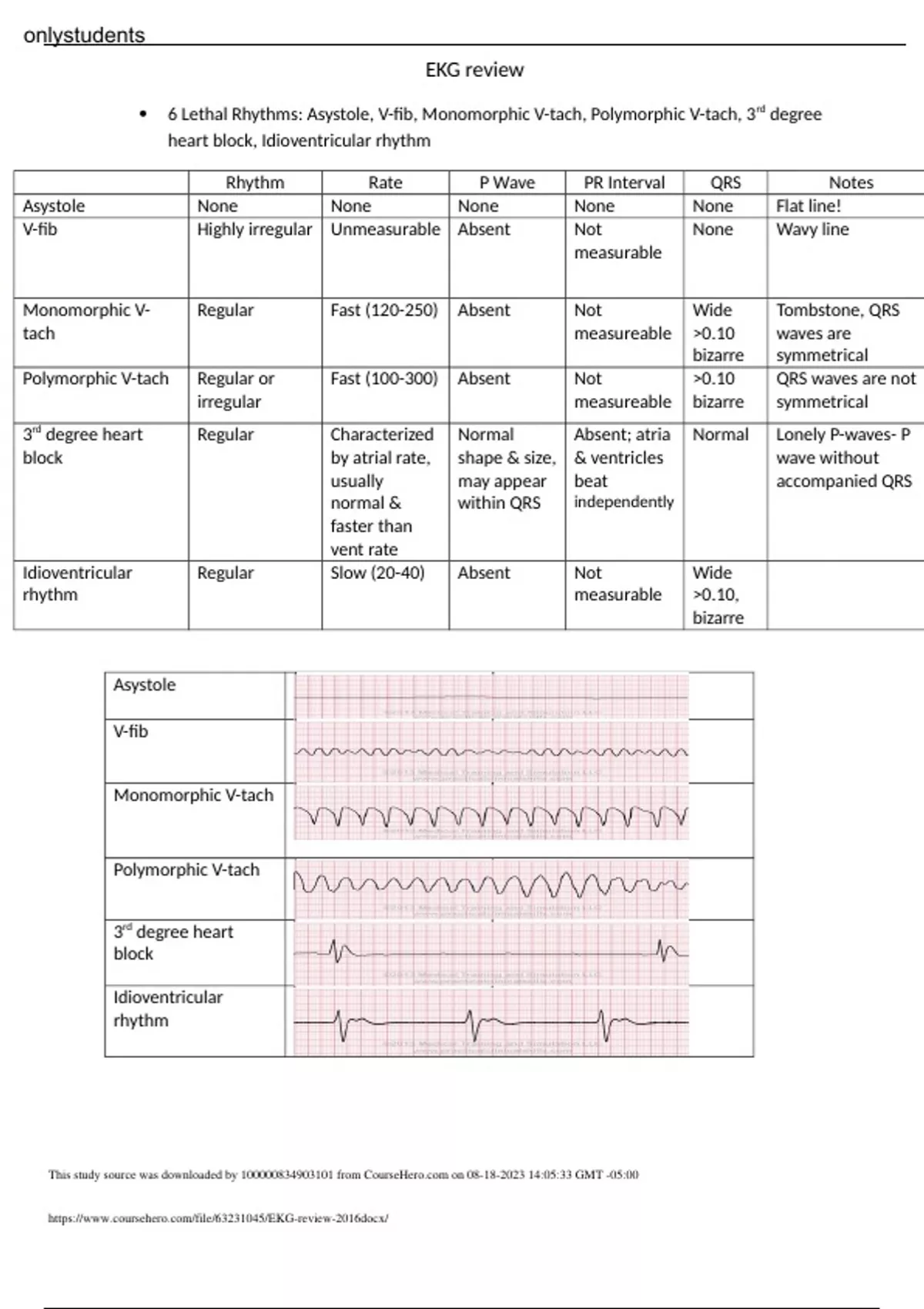 EKG review 6 Lethal Rhythms: Asystole, V-fib, Monomorphic V-tach ...