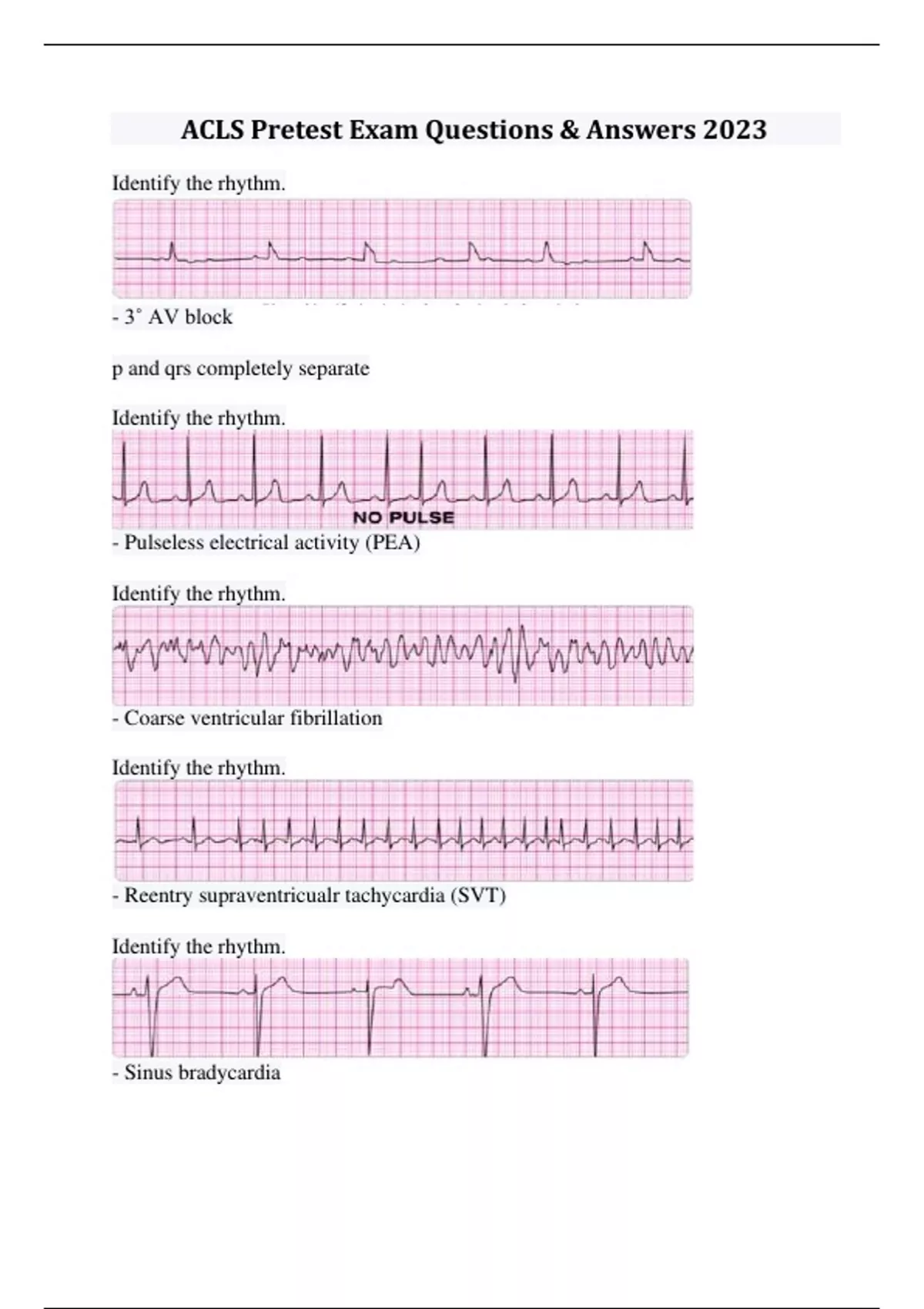 ACLS Pretest Exam Questions & Answers 2023 - Acls - Stuvia US