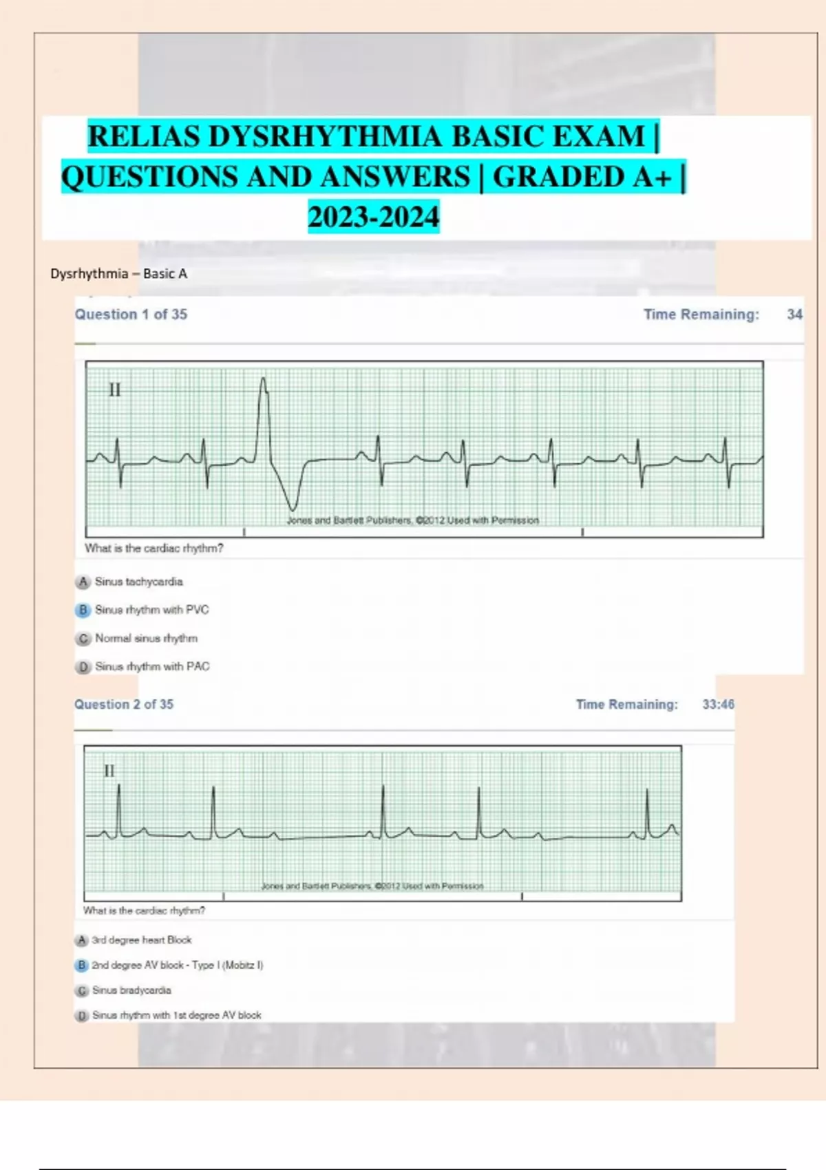RELIAS DYSRHYTHMIA BASIC EXAM | QUESTIONS AND ANSWERS | GRADED A+ ...