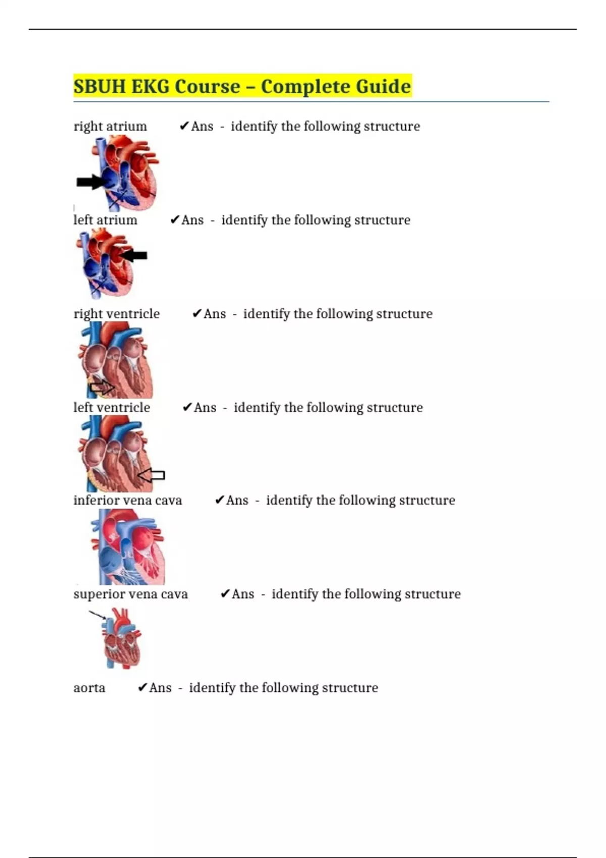 SBUH EKG Course – Complete Guide - SBUH - Stuvia US
