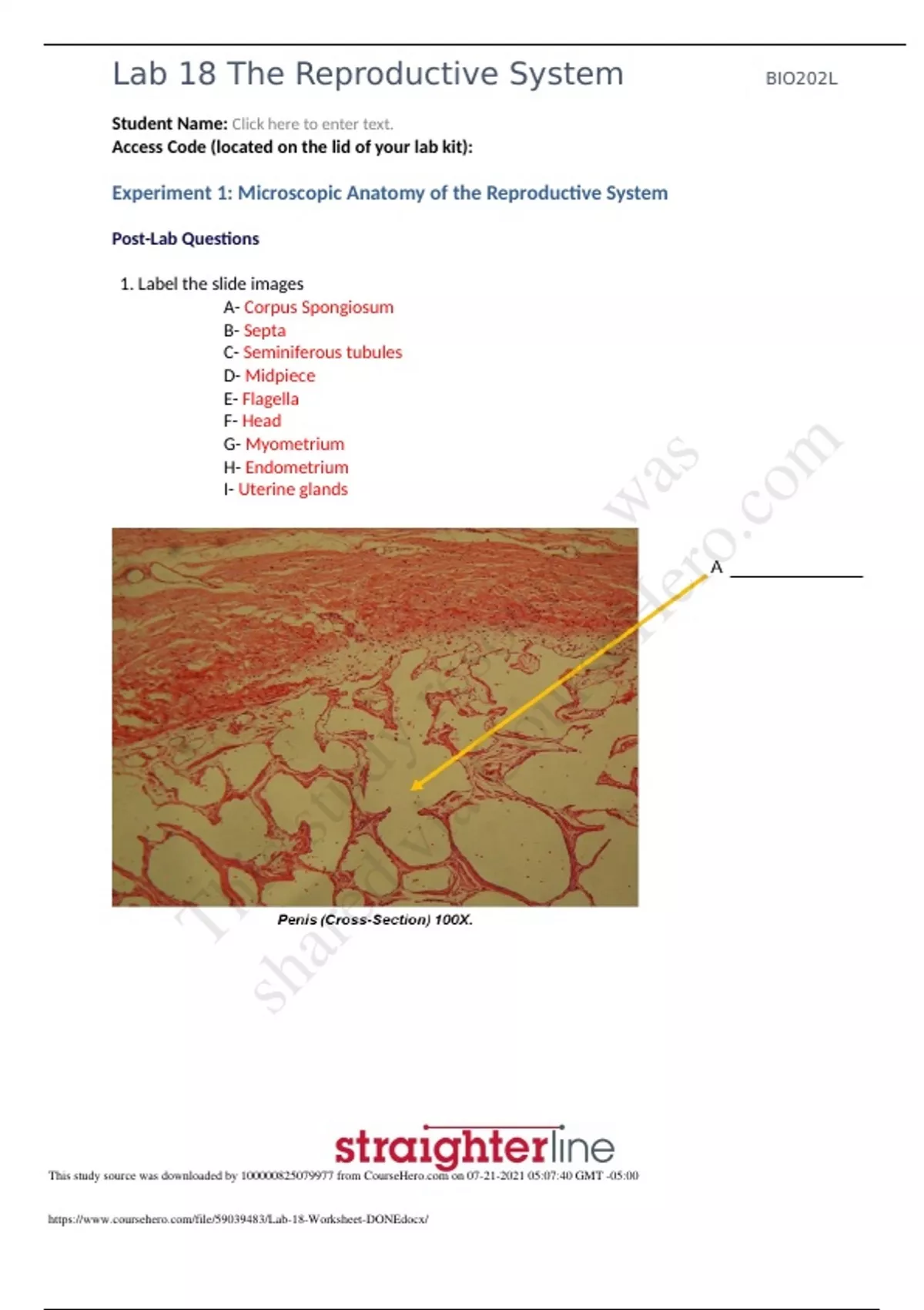 BIO 202L Lab 18 Worksheet- The Reproductive System - BIO 202L - Stuvia US