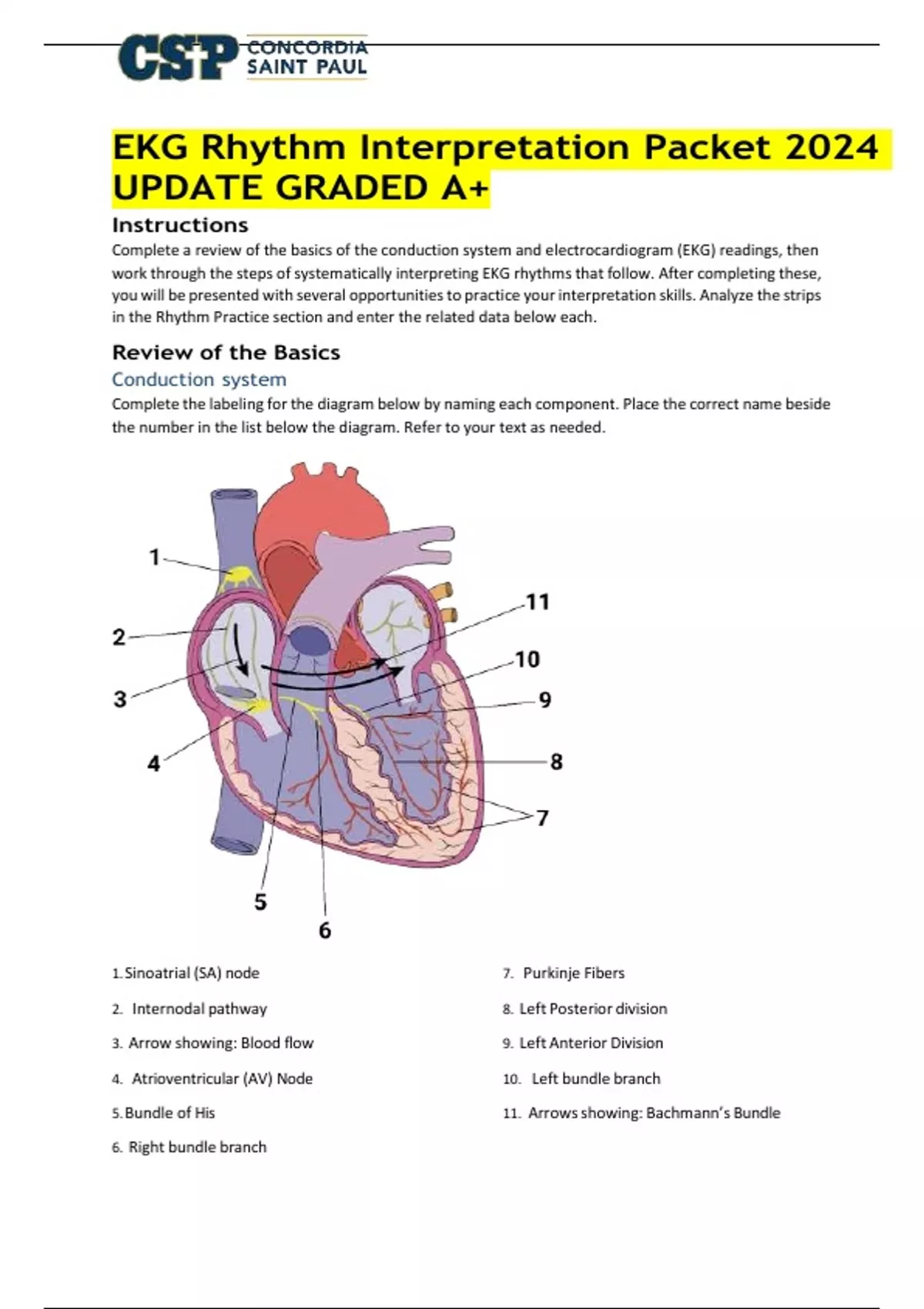 EKG Rhythm Interpretation Packet 2024 UPDATE GRADED A+ - EKG Rhythm ...