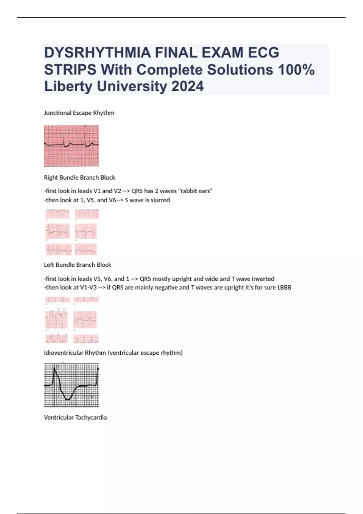 DYSRHYTHMIA FINAL EXAM ECG STRIPS With Complete Solutions 100% Liberty ...
