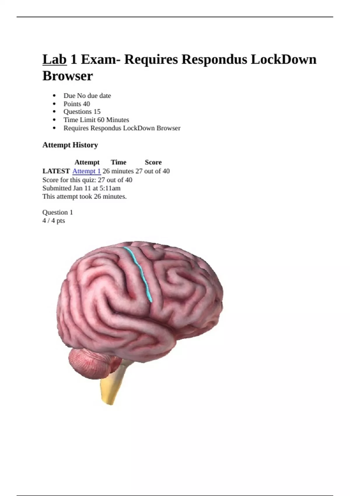 BIOD 152 / BIOD152 (Latest 2023 / 2024) A & P 2 Lab 1 Exam Portage ...