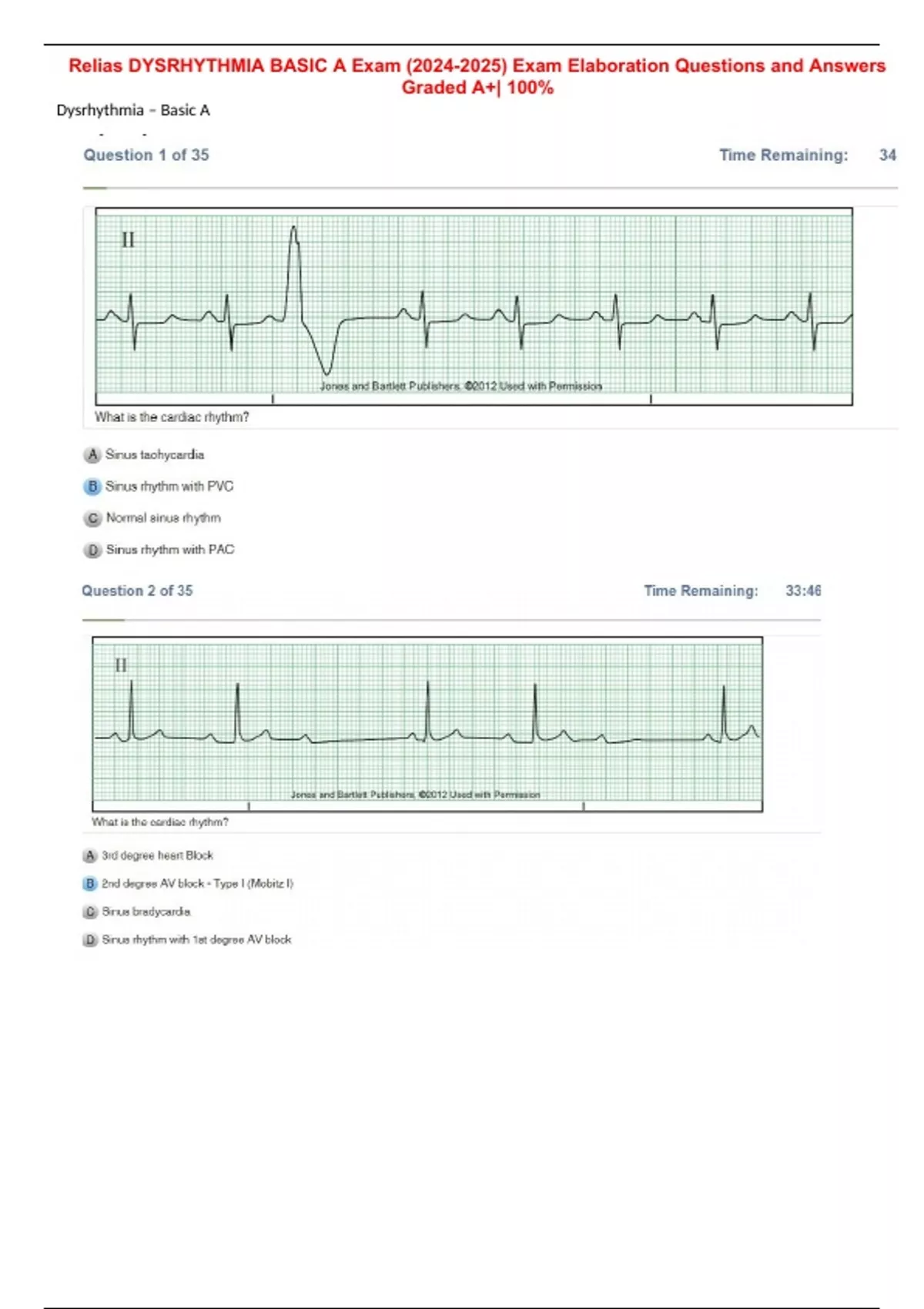Relias DYSRHYTHMIA BASIC A Exam () Exam Elaboration Questions and ...