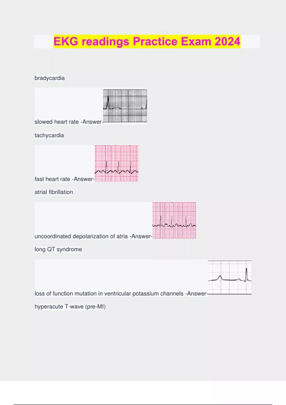 EKG readings Practice Exam 2024 - EKG - Stuvia US