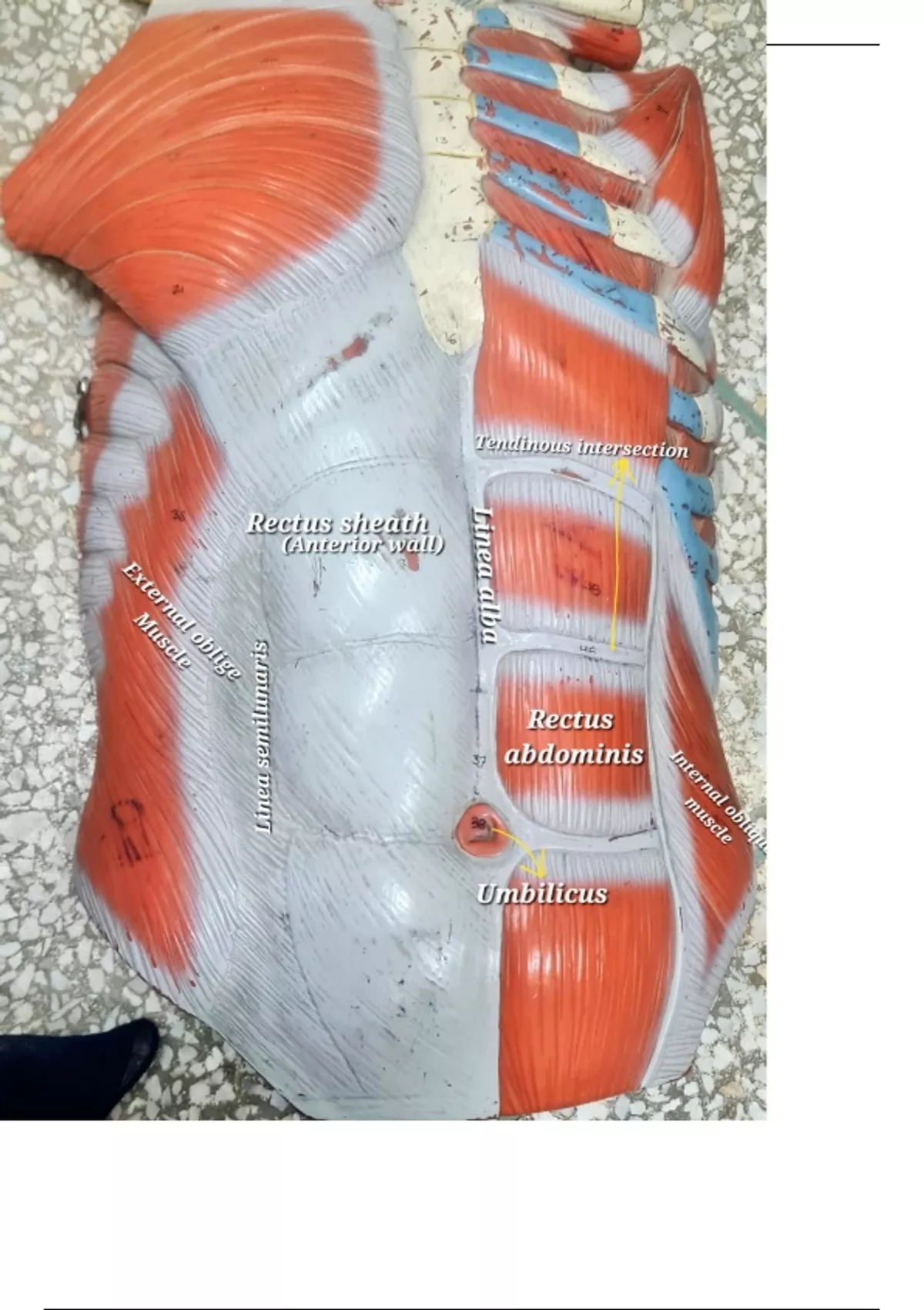 Summary ANTERIOR ABDOMINAL WALL MODEL LABELLED - Anatomy 1 (ANATOMY1 ...