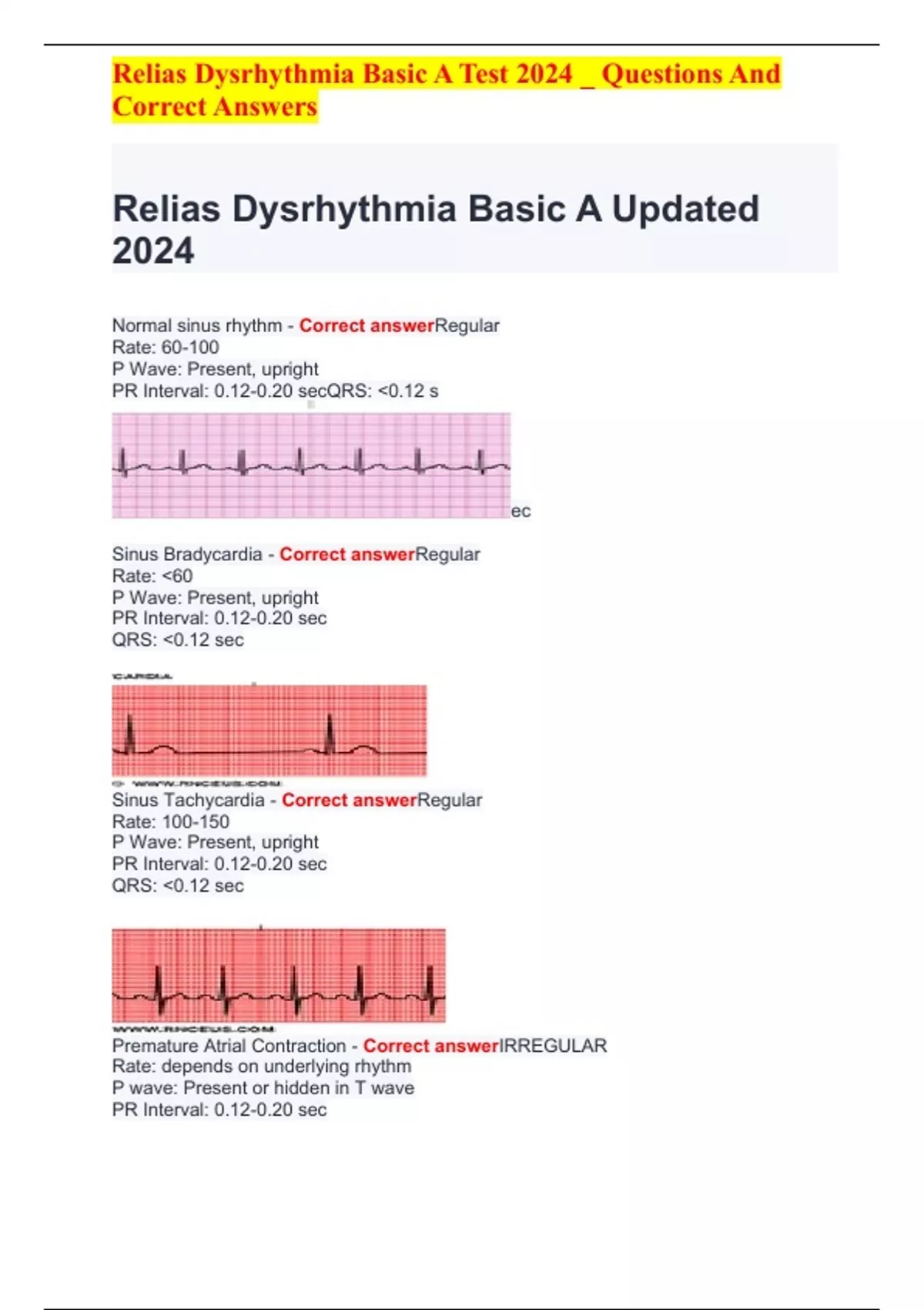 Relias Dysrhythmia Basic A Test 2024 _ Questions And Correct Answers ...