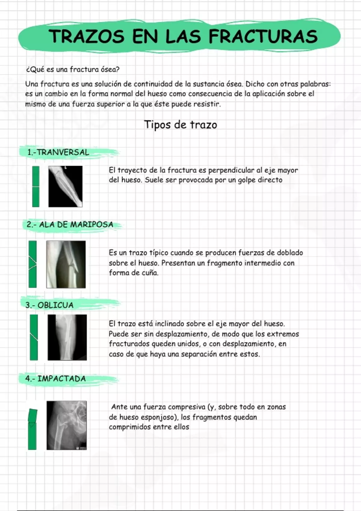 trazos de fracturas oseas - Ortopedia - Stuvia ES