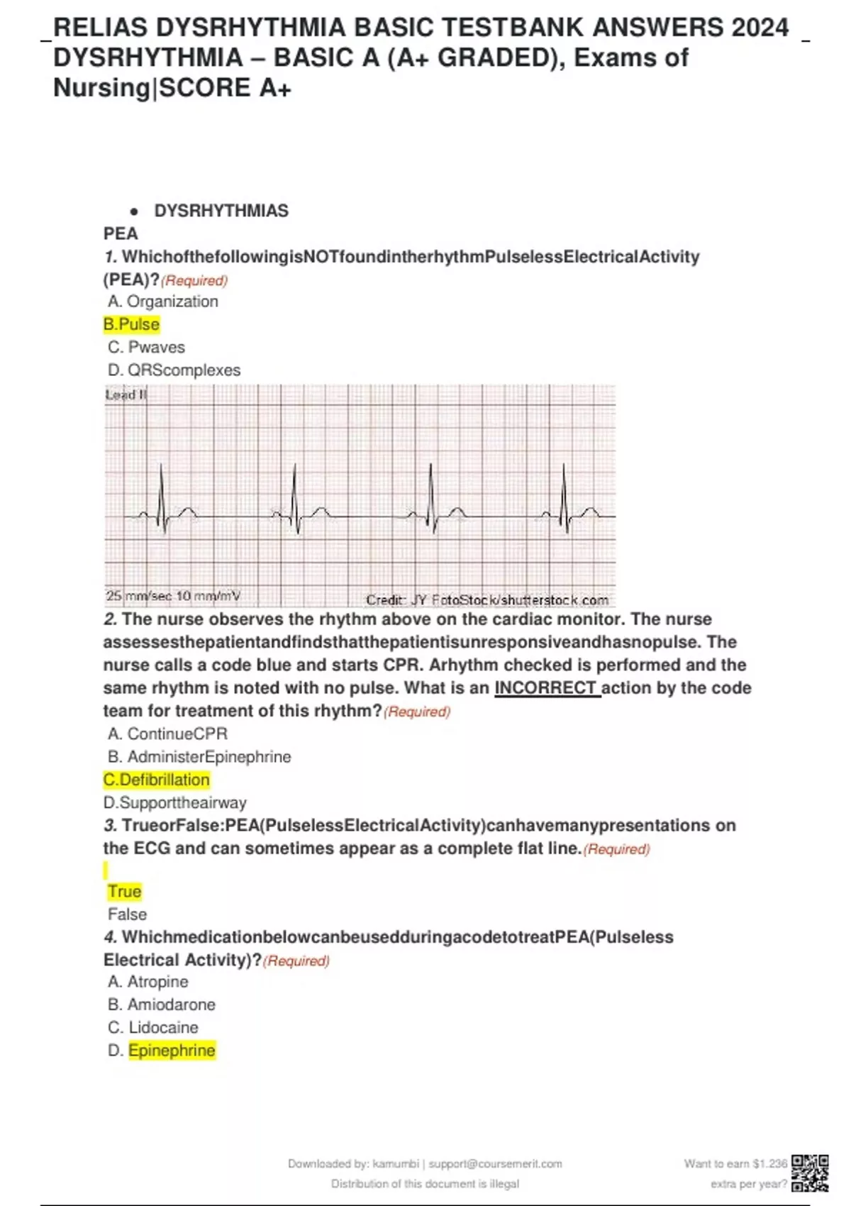 RELIAS DYSRHYTHMIA BASIC TESTBANK ANSWERS 2024 DYSRHYTHMIA – BASIC A ...