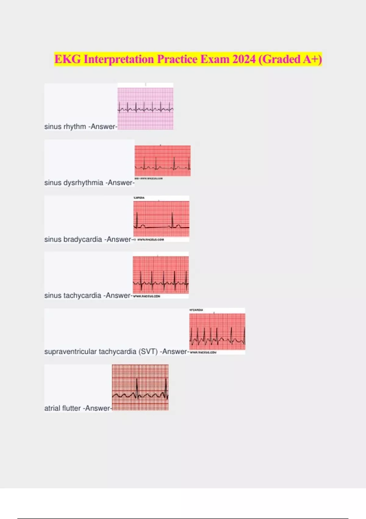 EKG Interpretation Practice Exam 2024 (Graded A+) - Ekg - Stuvia US