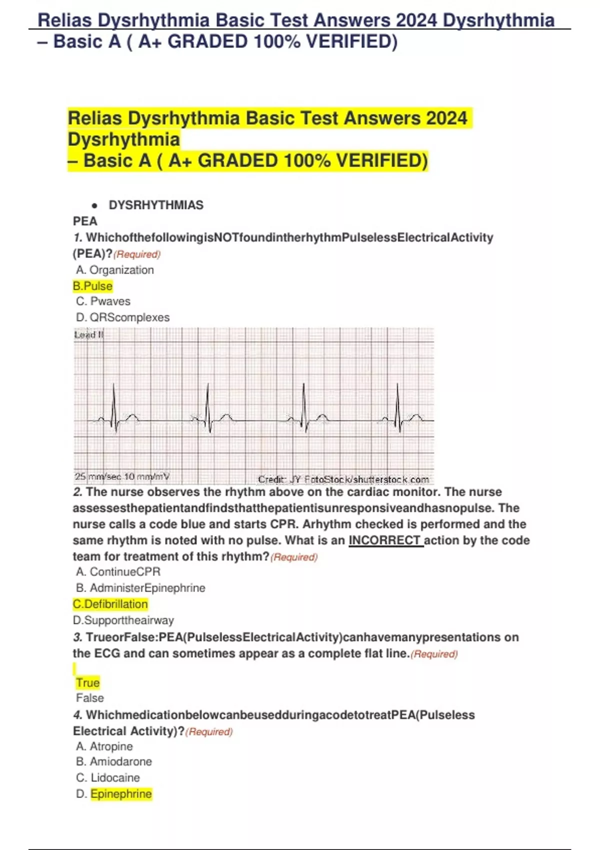 Relias Dysrhythmia Basic Test Answers 2024 Dysrhythmia Basic A ( A+ ...
