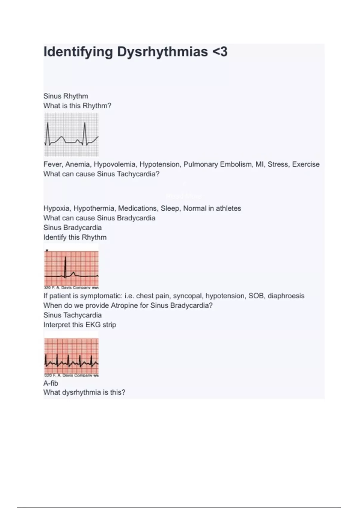 Identifying Dysrhythmias 3 Exam Questions And Answers - Dysrhythmias ...