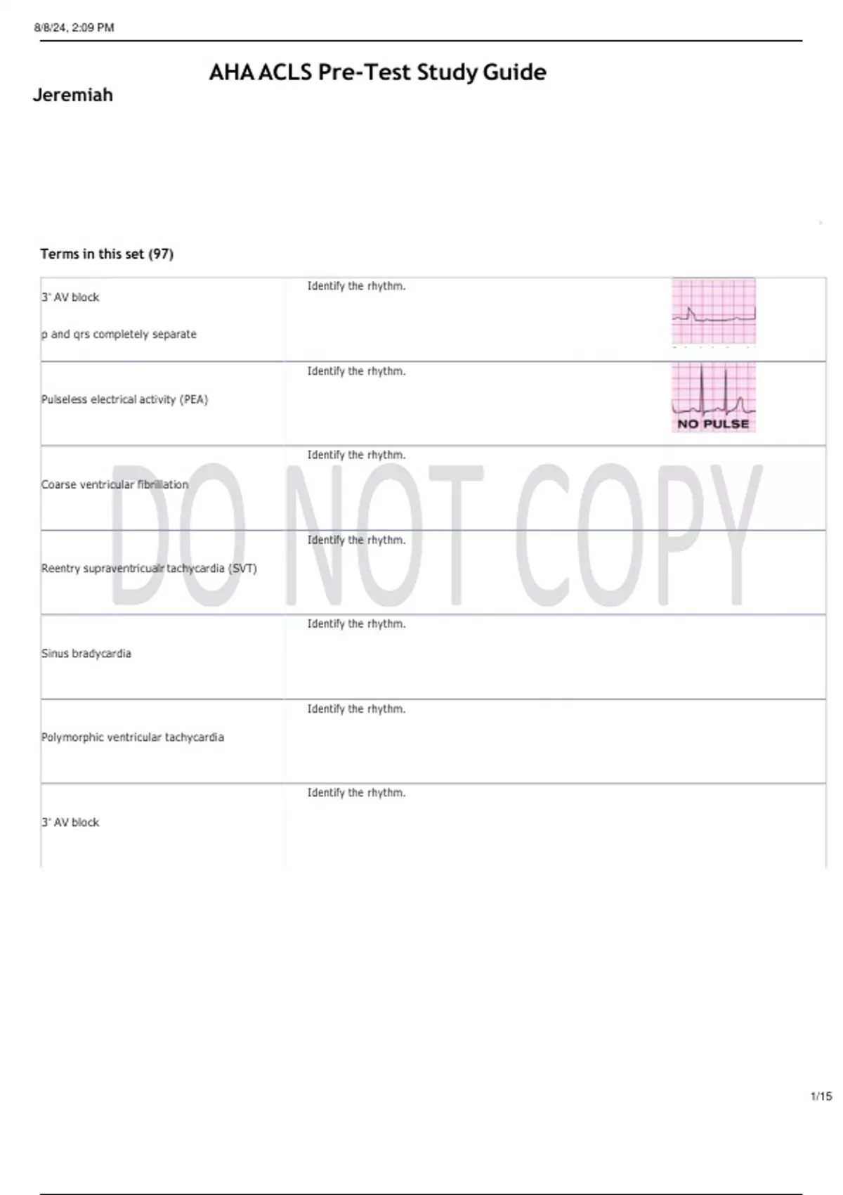 AHA ACLS Pre-Test Study Guide Terms in this set (97) 3˚ AV block p and ...