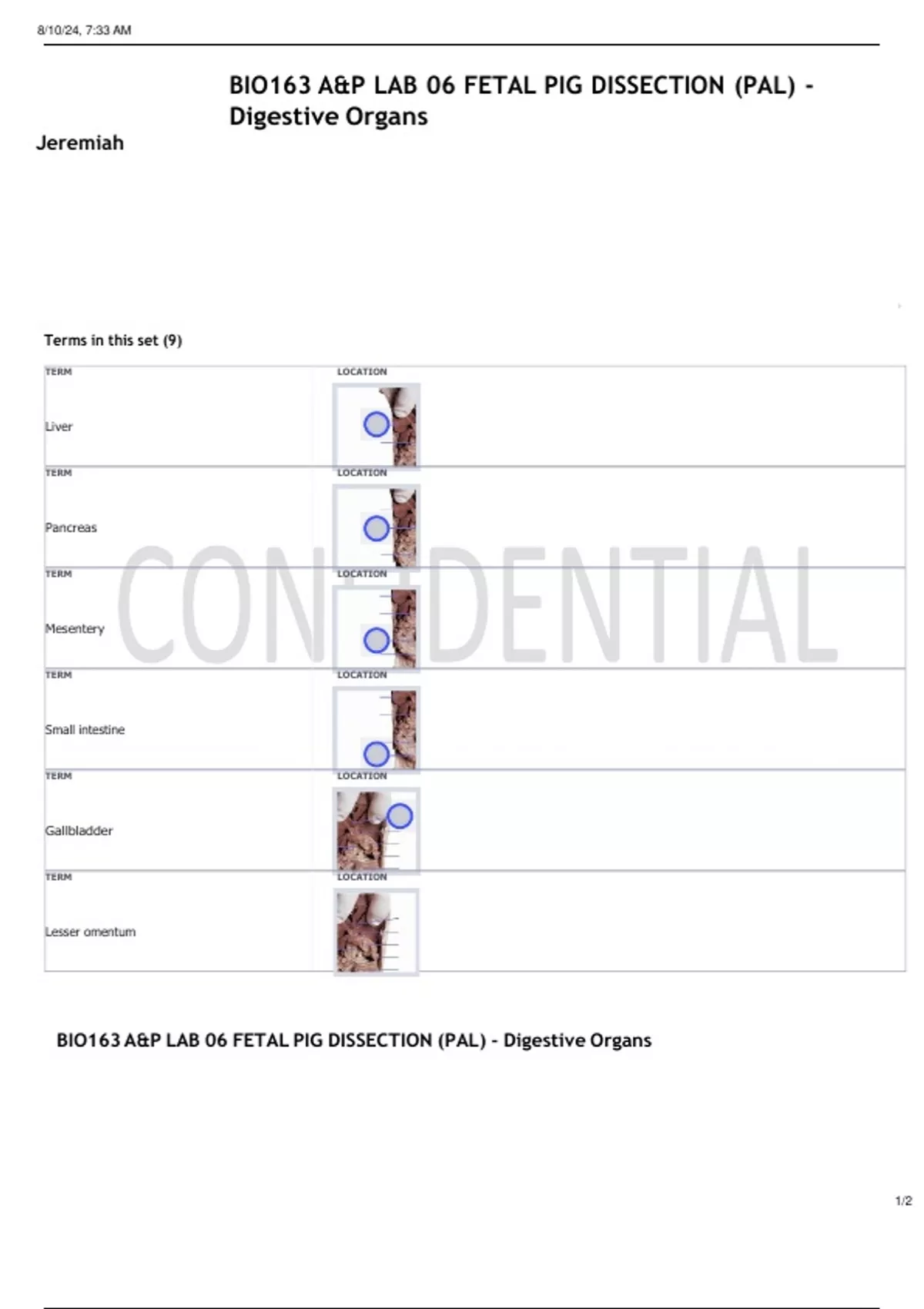 BIO163 A&P LAB 06 FETAL PIG DISSECTION (PAL) - Digestive Organs Diagram ...
