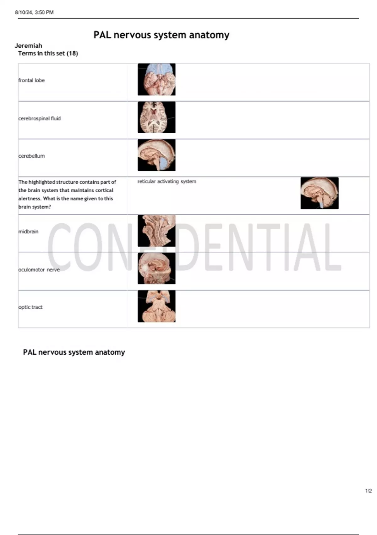 PAL nervous system anatomy Terms in this set (18) frontal lobe ...