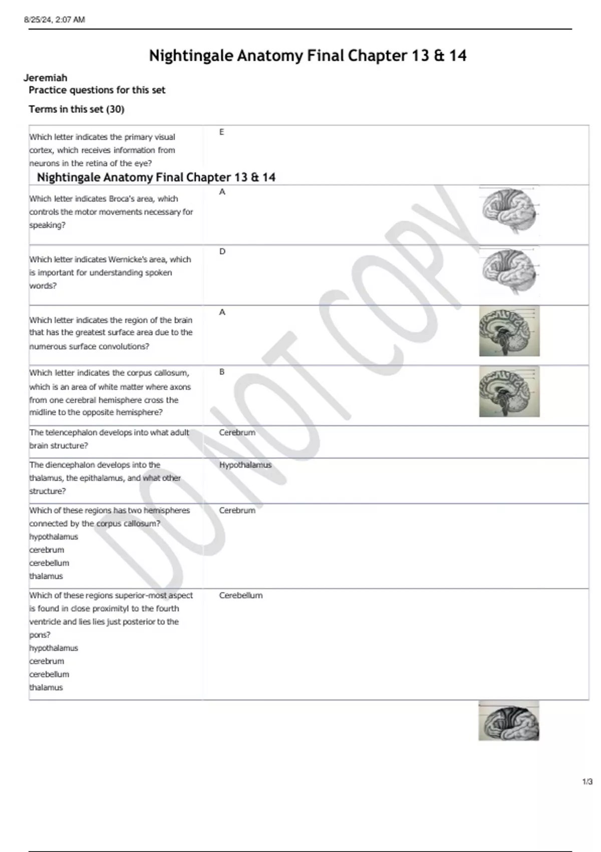 Nightingale Anatomy Final Chapter 13 & 14 questions and answers graded ...