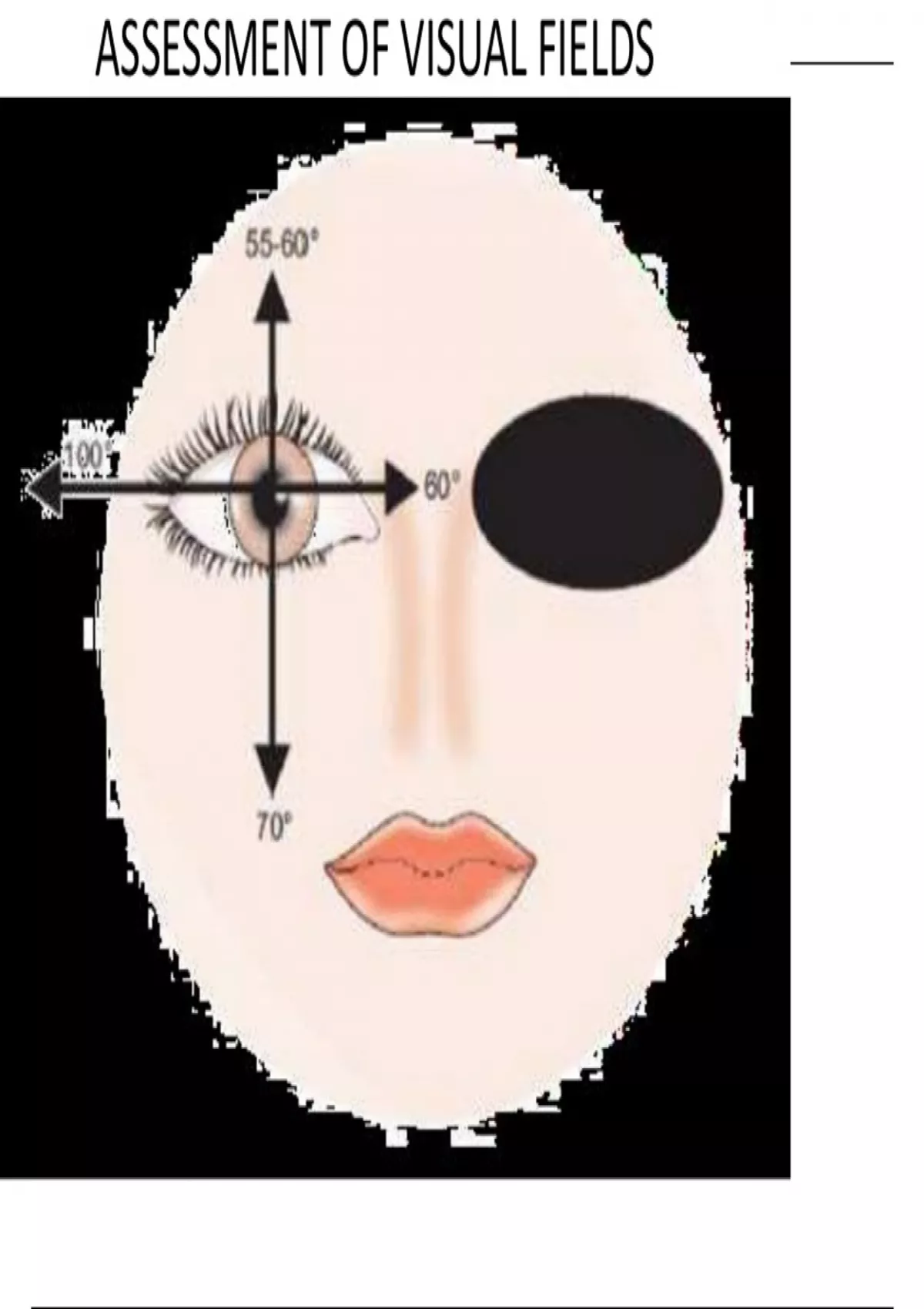 Assessment of Visual Fields: A Comprehensive Guide - Not Applicable - Stuvia US