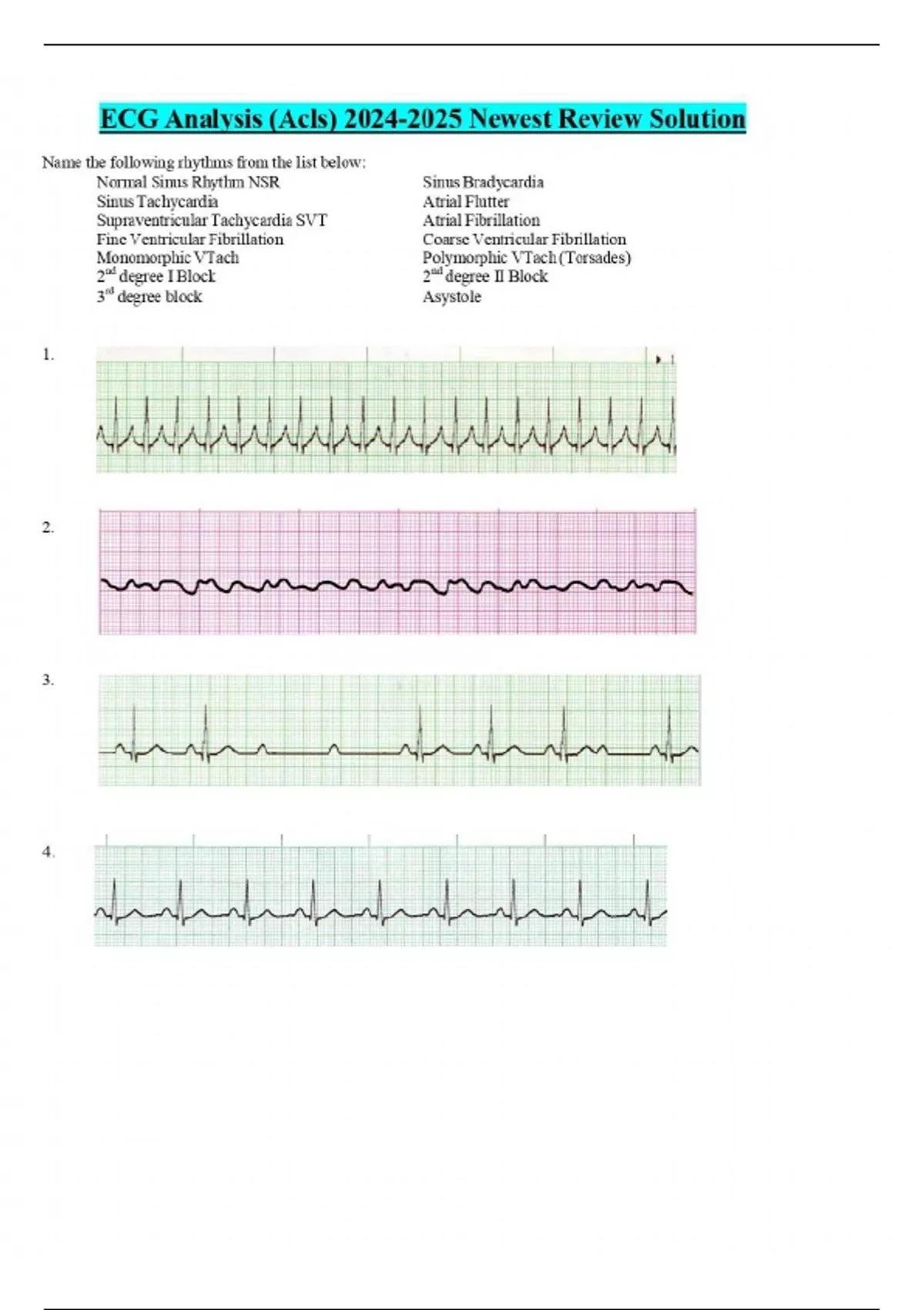 ECG Analysis (Acls) Newest Review Solution - ECG Analysis 2024-2025 ...