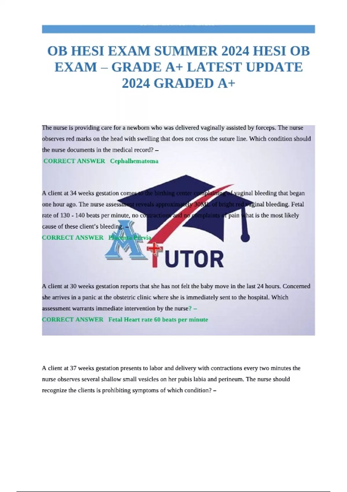 OB HESI EXAM SUMMER 2024 HESI OB EXAM - GRADE A+ LATEST UPDATE 2024 ...