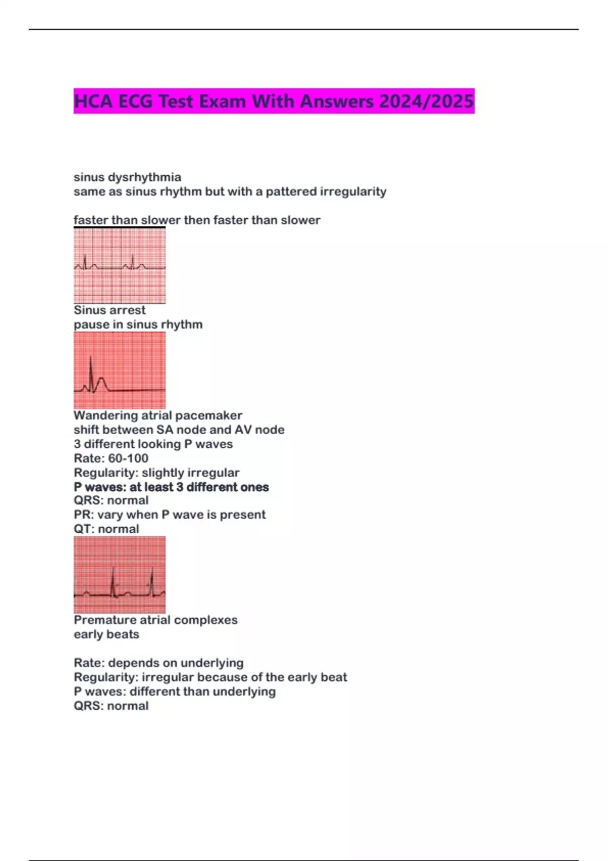 HCA ECG Test Exam With Answers 2024/2025 sinus dysrhythmia same as ...