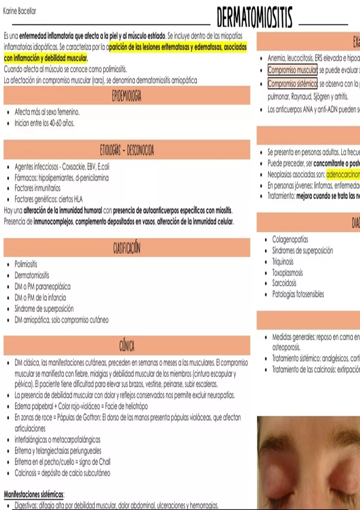 DERMATOMIOSITIS - Dermatologia - Stuvia US