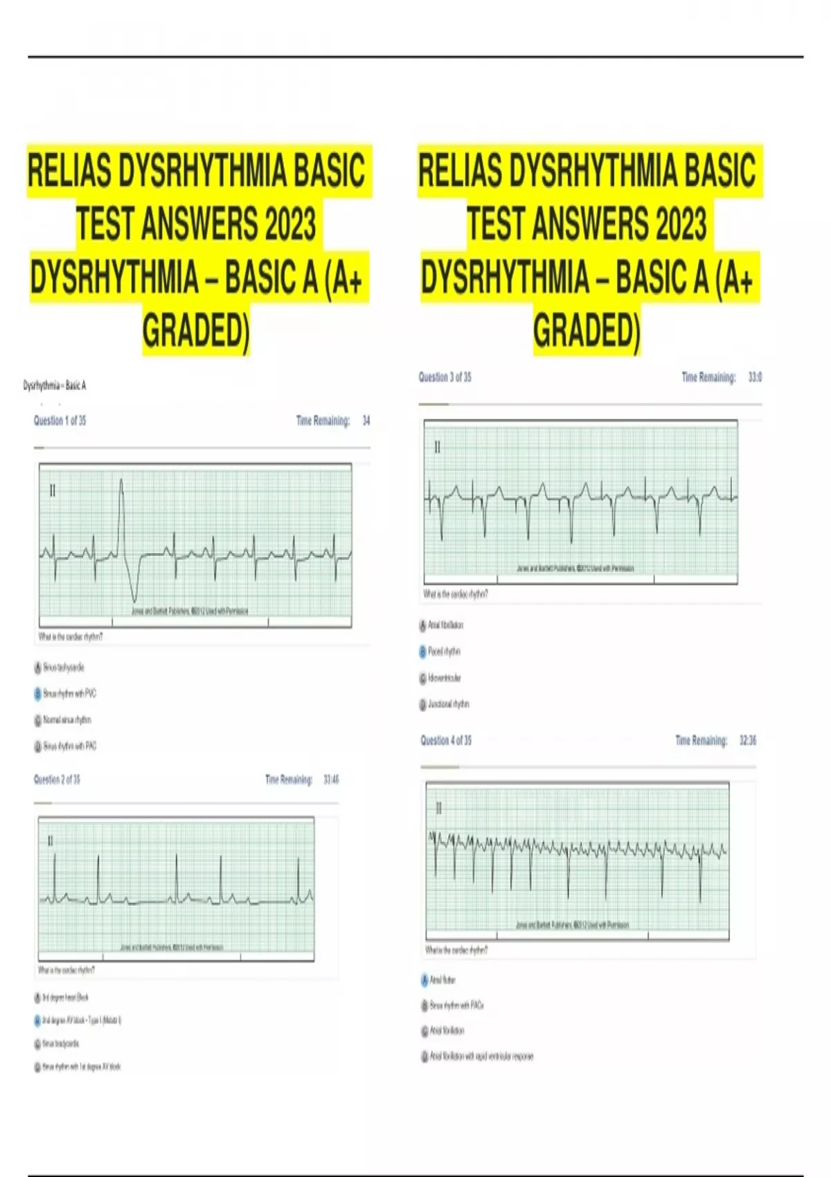 RELIAS DYSRHYTHMIA BASIC TEST ANSWERS DYSRHYTHMIA – BASIC A (A+ GRADED ...