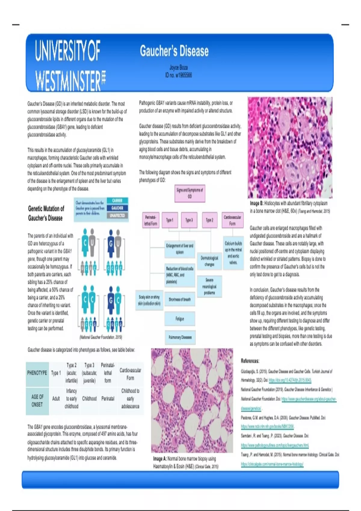 Poster about Gaucher's Disease - Metabolic Biochemistry - Stuvia UK