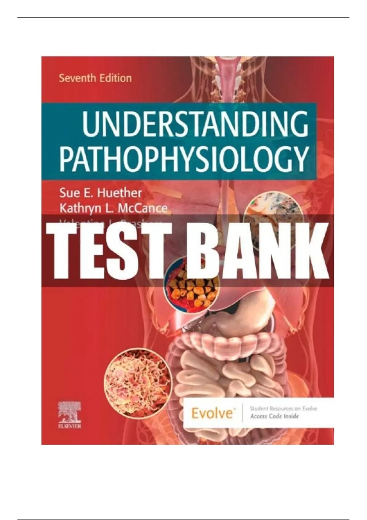 Test Bank Understanding Pathophysiology 7th Edition by Sue Huether ...