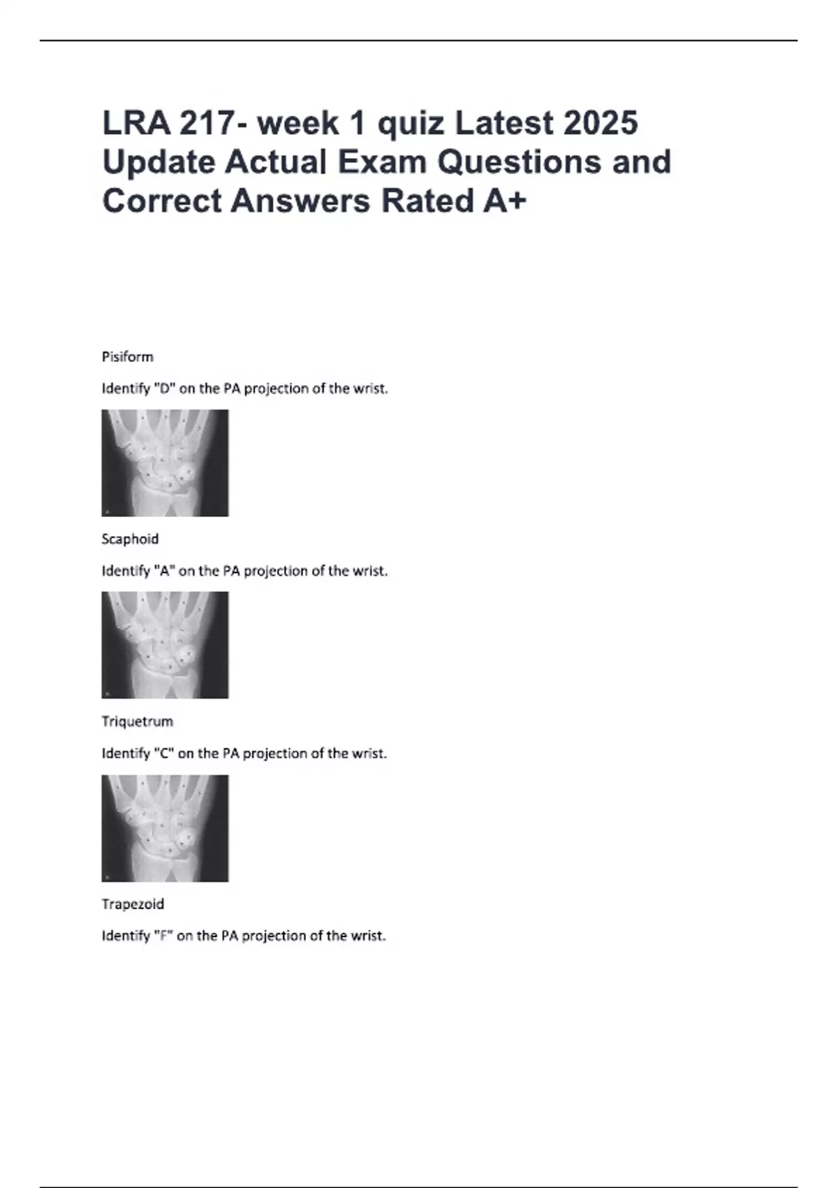 LRA 217- week 1 quiz Questions and Verified Answers (100% Correct Score ...