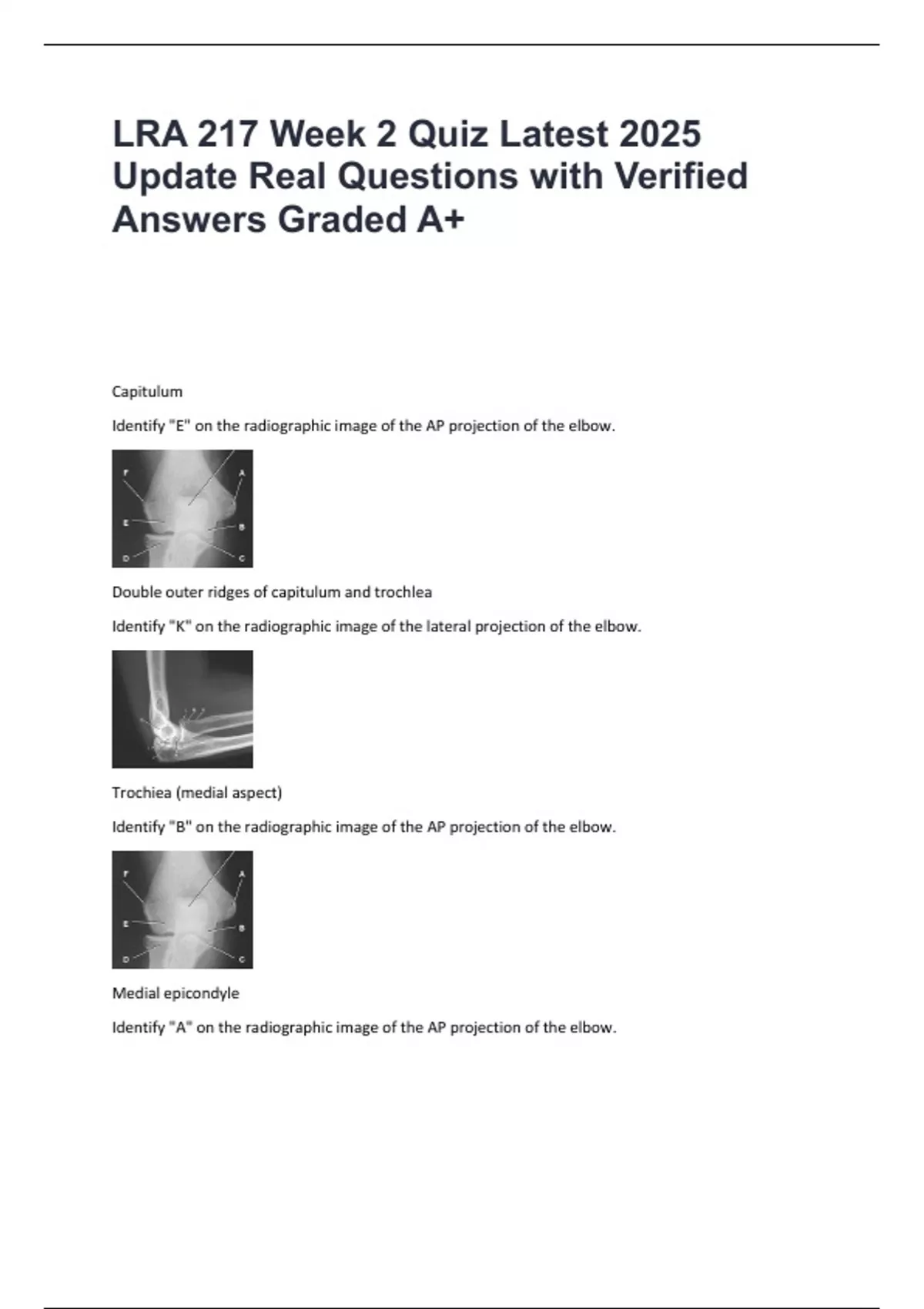 LRA 217 Week 2 Quiz Latest 2025 Update Real Questions with Verified ...