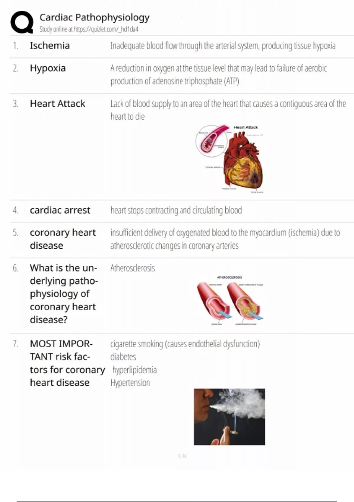 Cardiac arrhythmias pathophysiology quiz questions - Cardiac ...