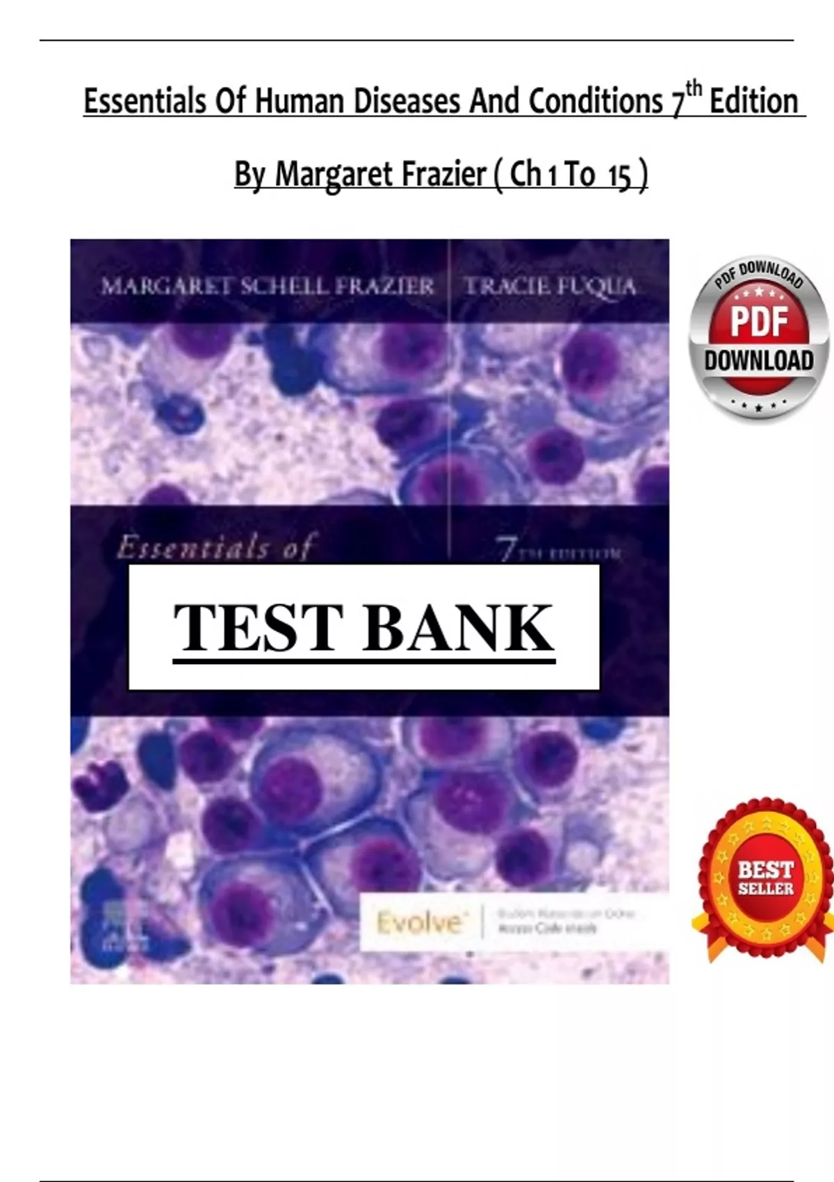 Essentials of Human Diseases and Conditions – Test Bank (Chapters 1–15 ...
