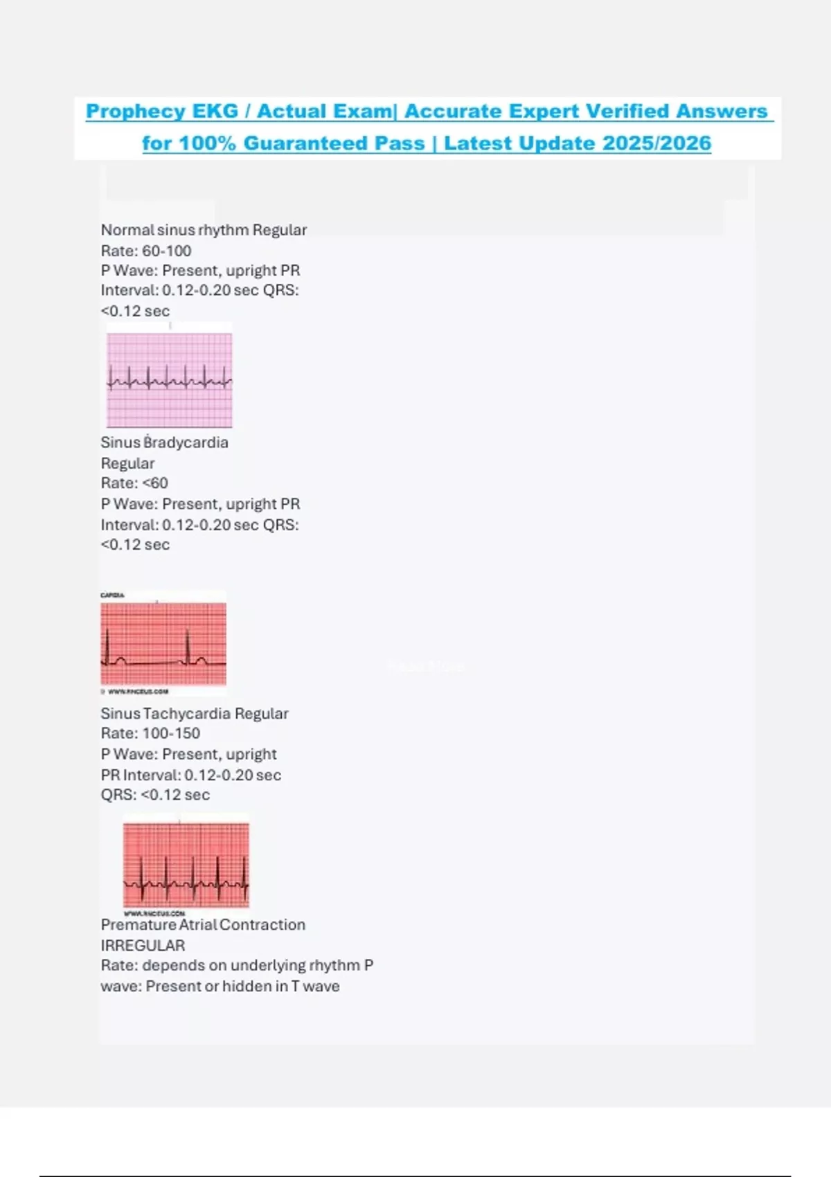 Relias Dysrhythmia Prophecy EKG Exam | Accurate Expert-Verified Answers ...