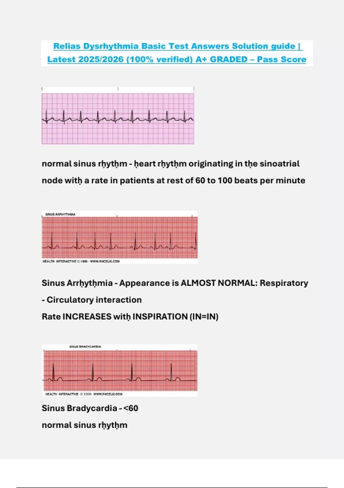 Relias Dysrhythmia Basic Test Answers – Solution Guide | Latest 2025/ ...