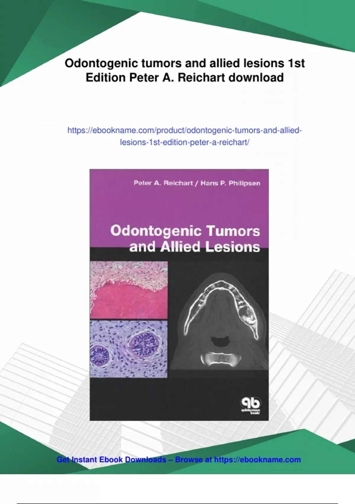 Summary Odontogenic tumors and allied lesions 1st Edition Peter A ...
