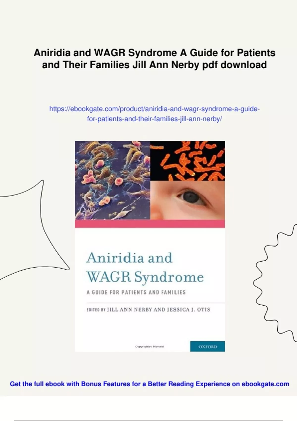 Summary Aniridia and WAGR Syndrome A Guide for Patients and Their ...