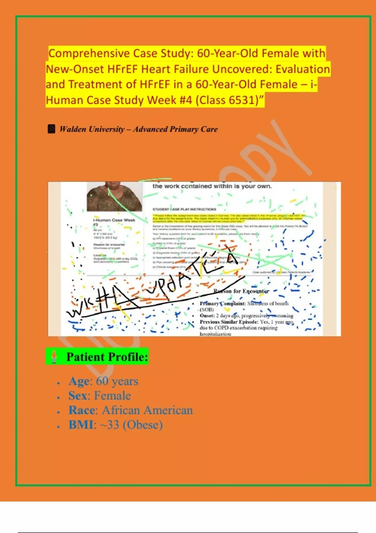 Comprehensive Case Study: 60-Year-Old Female with New-Onset HFrEF Heart Failure Uncovered ...
