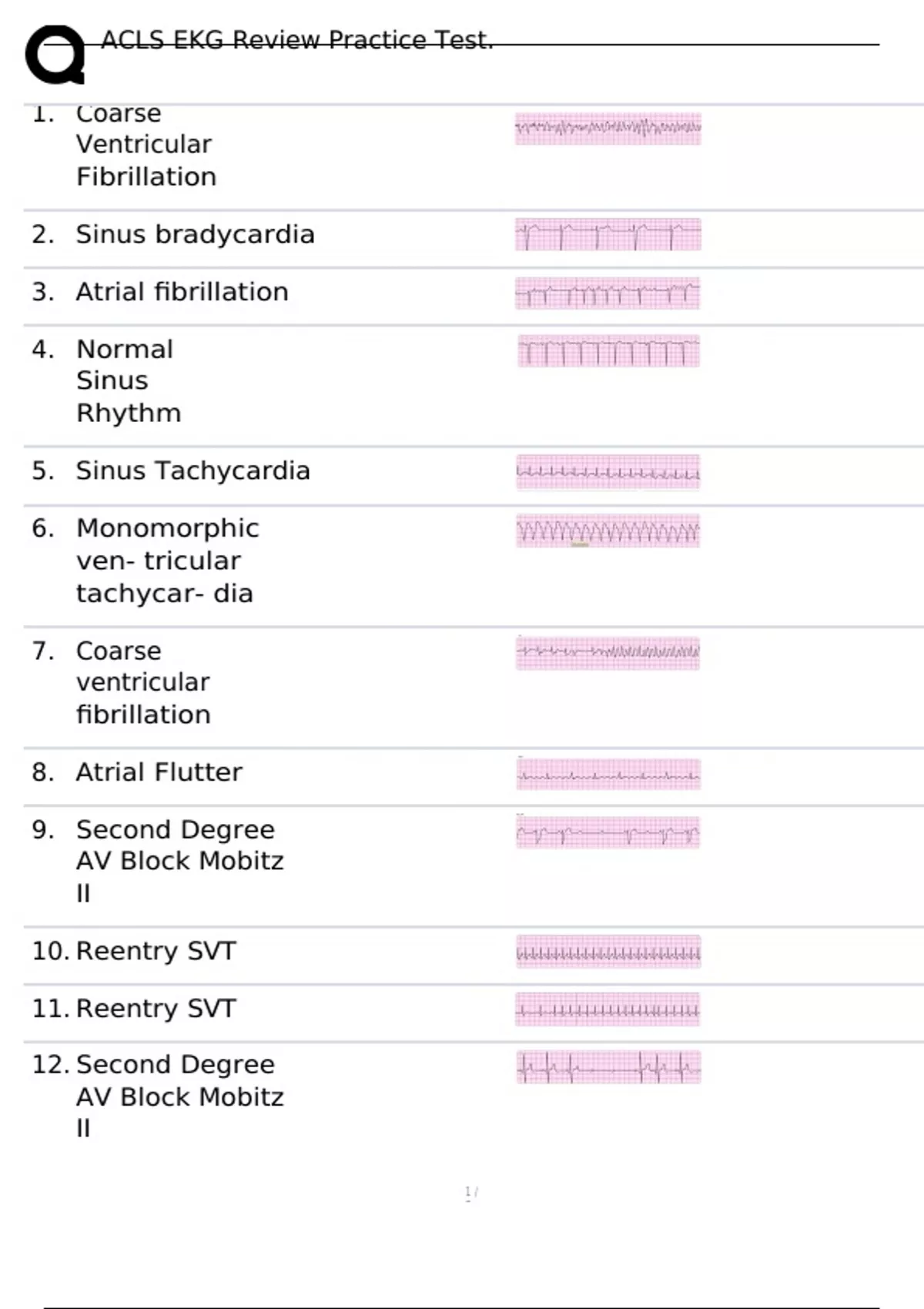 ACLS EKG Review Practice Test. - AHA ACLS - Stuvia US