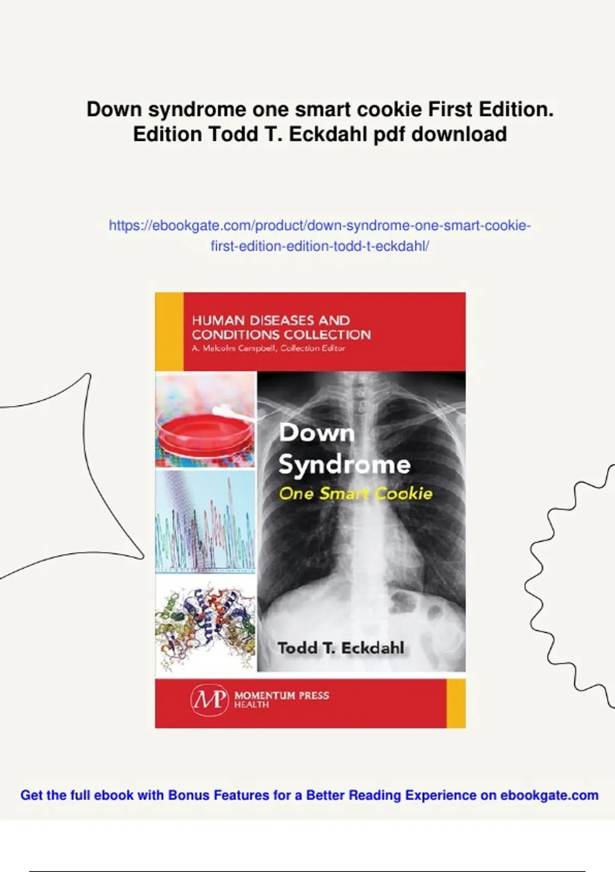 Summary Down syndrome one smart cookie First Edition. Edition Todd T ...