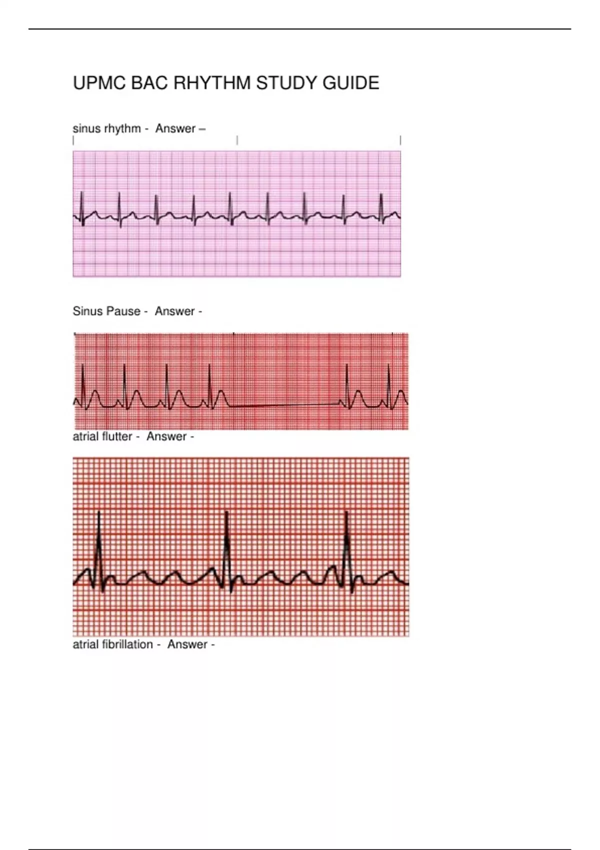 UPMC BAC RHYTHM STUDY GUIDE - UPMC BAC - Stuvia US