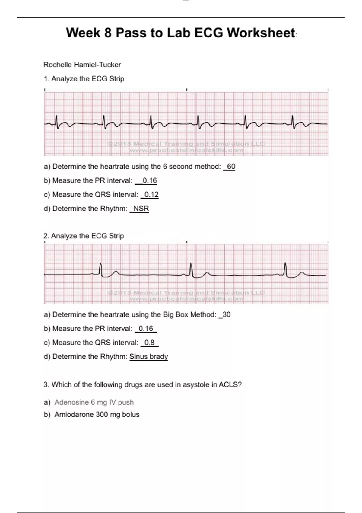 Week 8 Pass to Lab ECG Worksheet questions and answers with complete ...