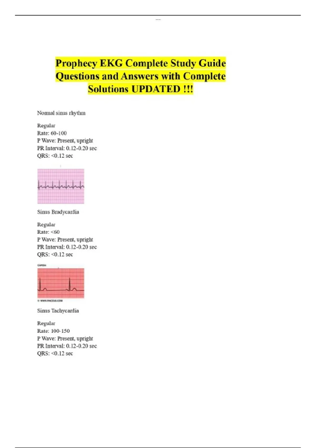 ophecy EKG Complete Study Guide Questions and Answers with Complete ...